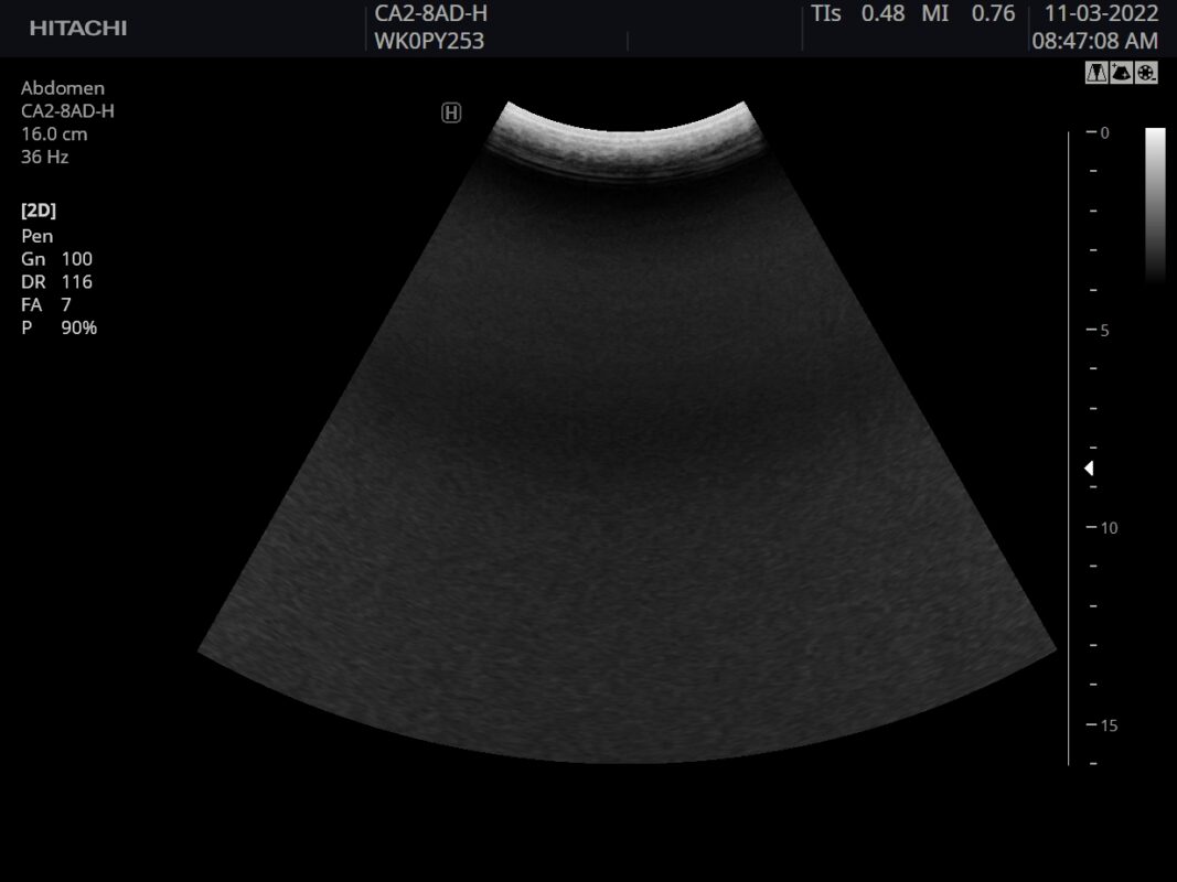 Dormed Hellas – Hitachi CA2-8AD-H Convex Probe - FUTUS